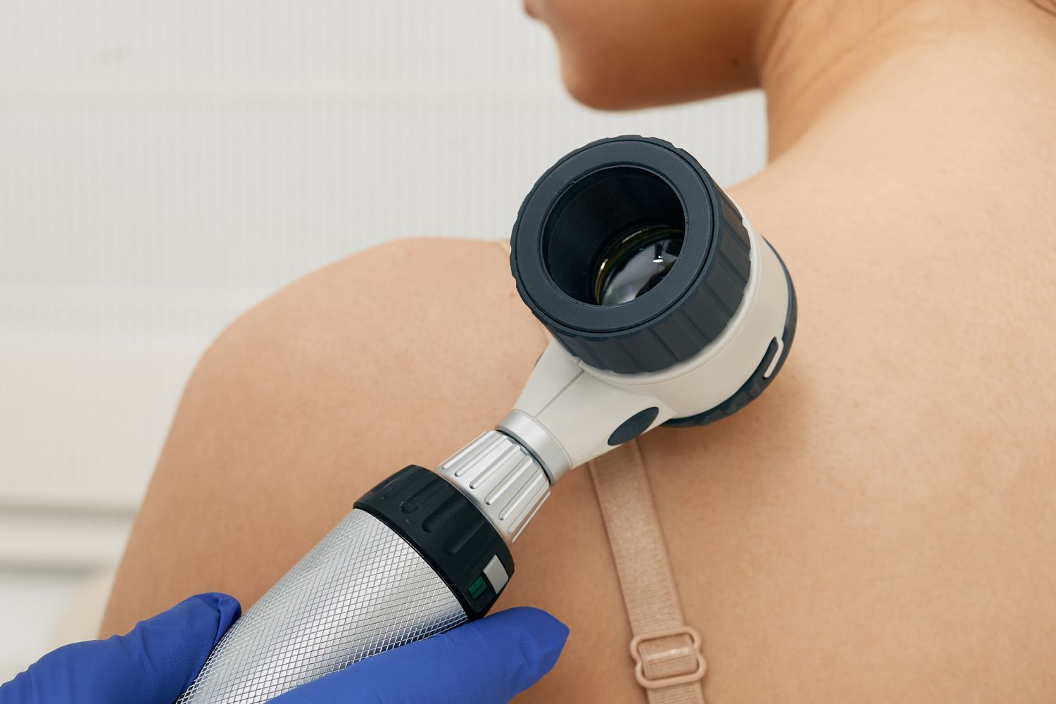 Skin Cancer Checks Brisbane | Carina Medical and Specialist Centre